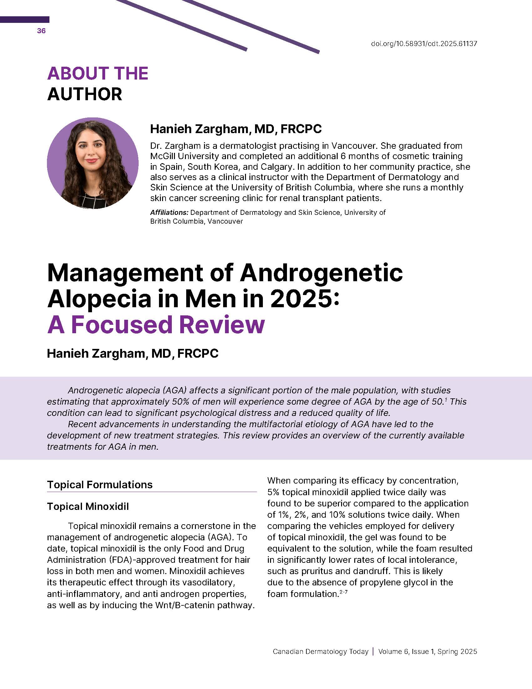 Management of Androgenetic Alopecia in Men in 2025: A Focused Review | Canadian Dermatology Today